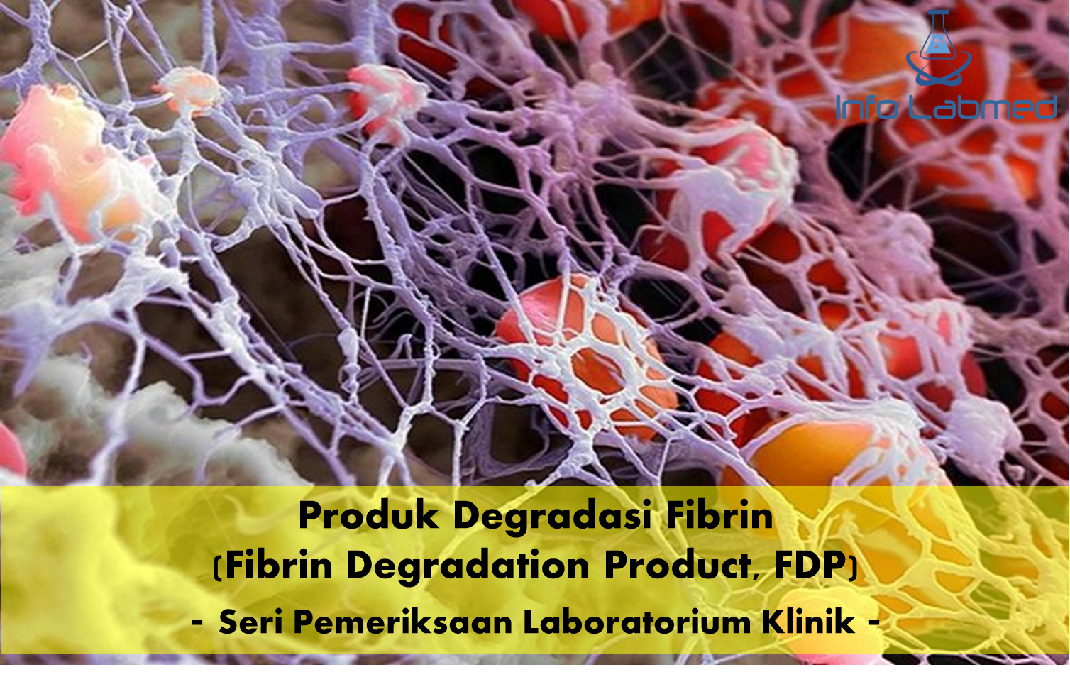Produk Degradasi Fibrin (Fibrin Degradation Product, FDP) (Serum ...