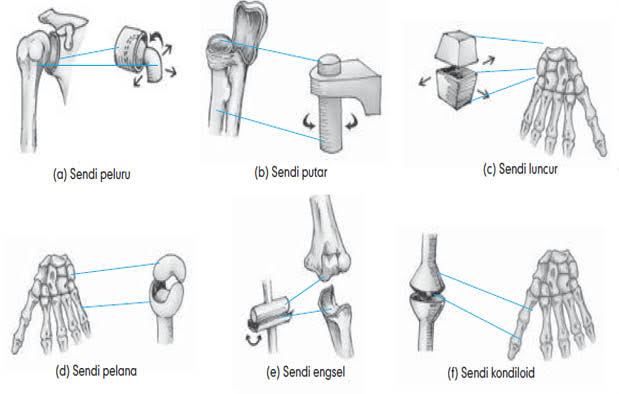 Belajar IPA: Macam macam kelainan atau penyakit tulang pada manusia ...