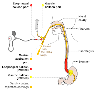 Nutrition4kids: June 2017