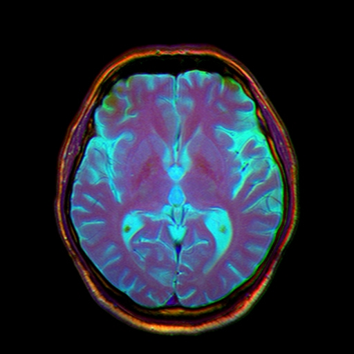 Nevit's blog: Color MRI of the Brain