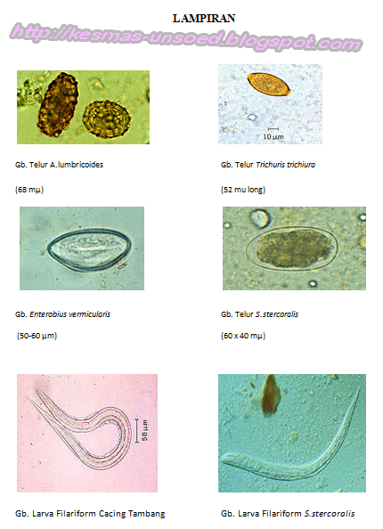 Laporan Praktikum Parasitologi Pemeriksaan Feses - [DOCX Document]