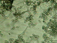 MICOLOGIA PANAMENSIS: Notas Micologicas (143). Observaciones sobre el ...