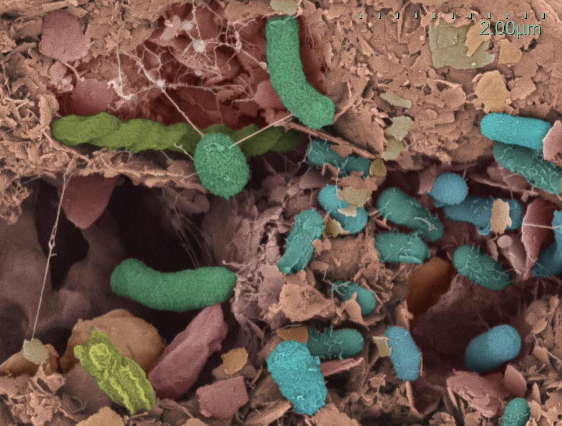 Of Bacteria and Men: A view of microbial life in soil