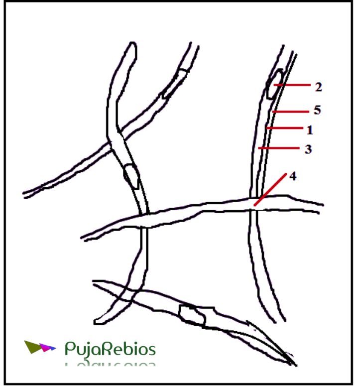 Laporan Antum BENTUK DAN BAGIAN SEL Rambut biji randu (Ceiba petandra)