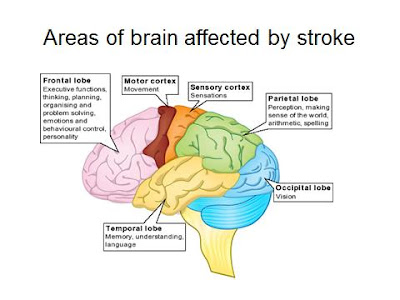 MamaKhalishShoppe: Penyakit Darah Tinggi Punca Utama Serangan Strok