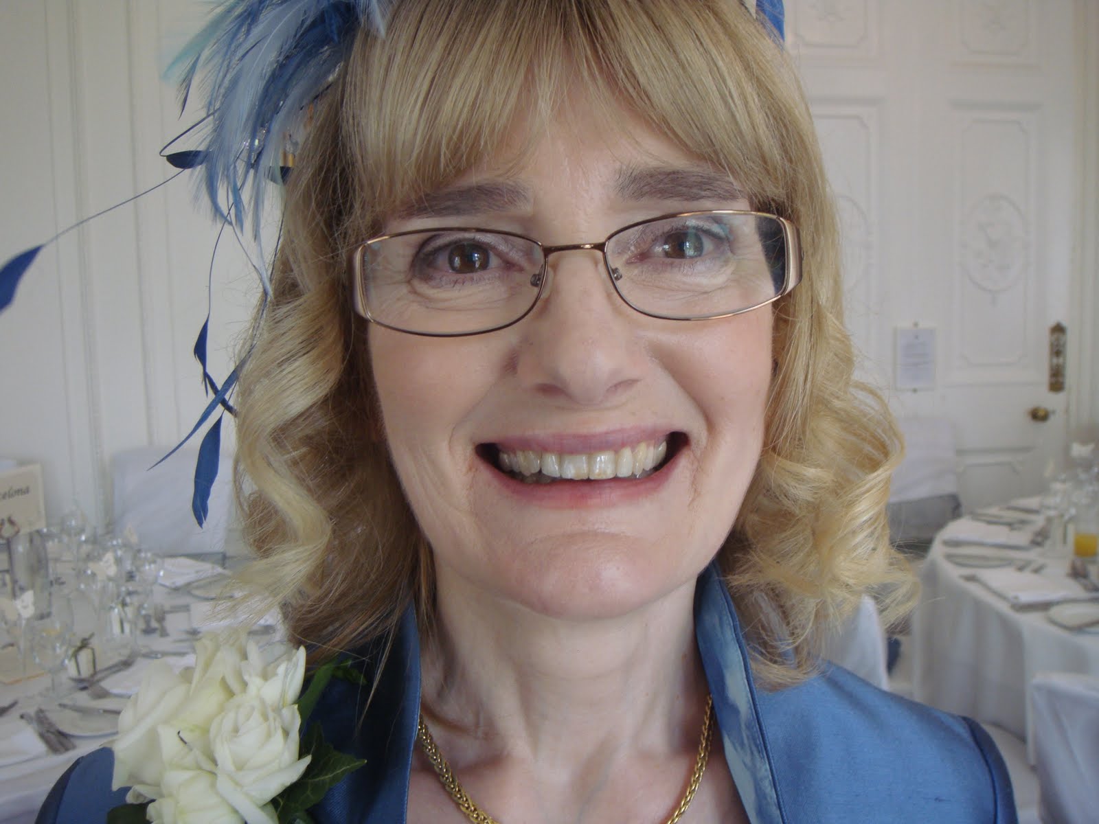 Braces at 56: Confident Smile on my Daughter's Wedding Day Thanks to ...