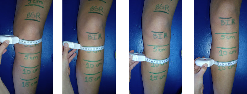 FisioEstudantes: Perimetria