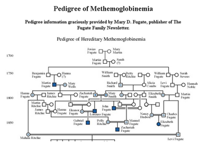 The Story of the "Blue People" of Troublesome Creek