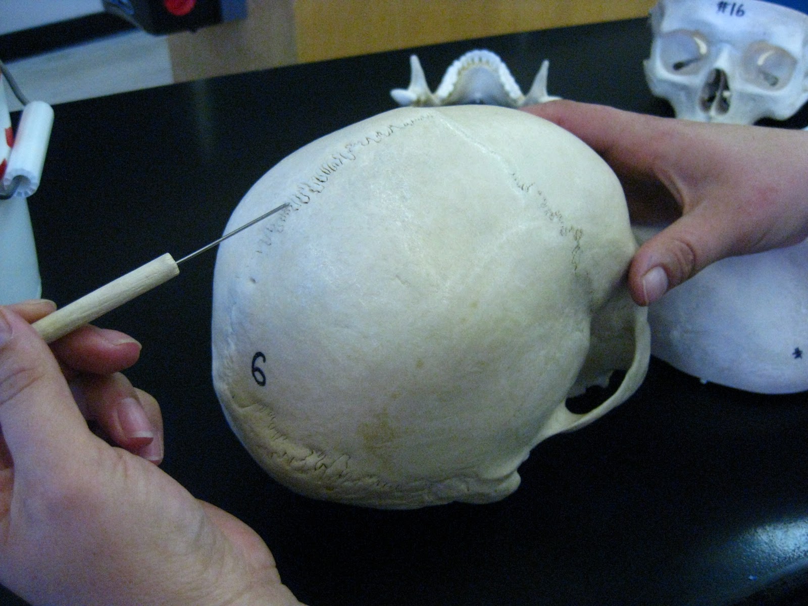Boned: Human Skull - sagittal suture (of parietal bones)