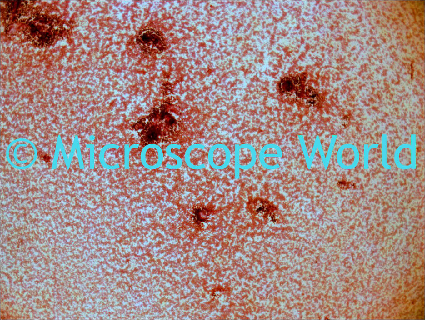 Microscope World Blog: E. Coli