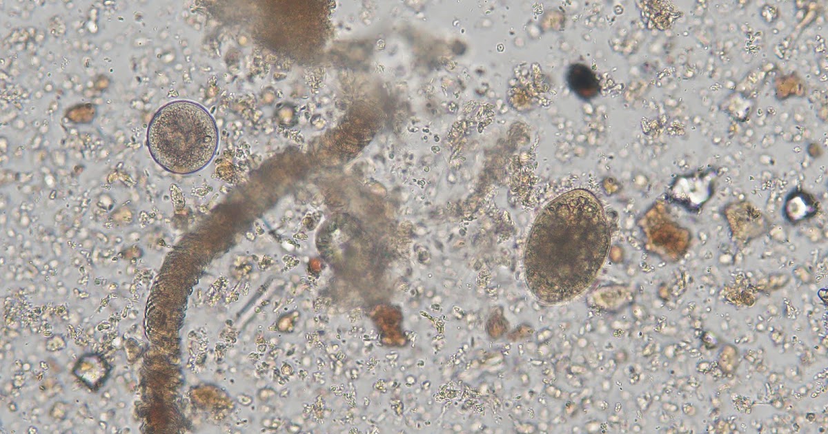 Creepy Dreadful Wonderful Parasites: Case of the Week 532