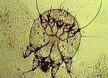 Penyakit Scabies dan Solusinya - HEALTHYNESIA