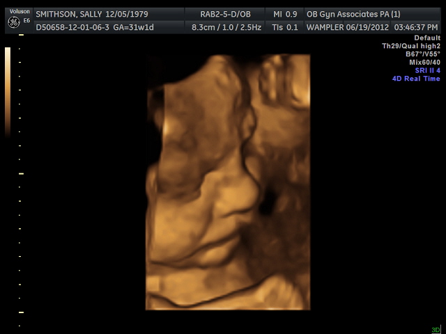 The Smithson Family: Cooper at 31 Weeks