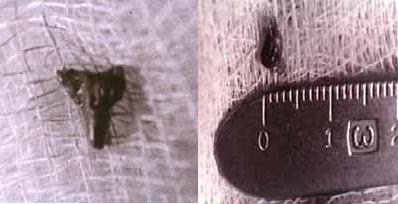 Alien Implantation ~ Dreams, Realities and Dimensions