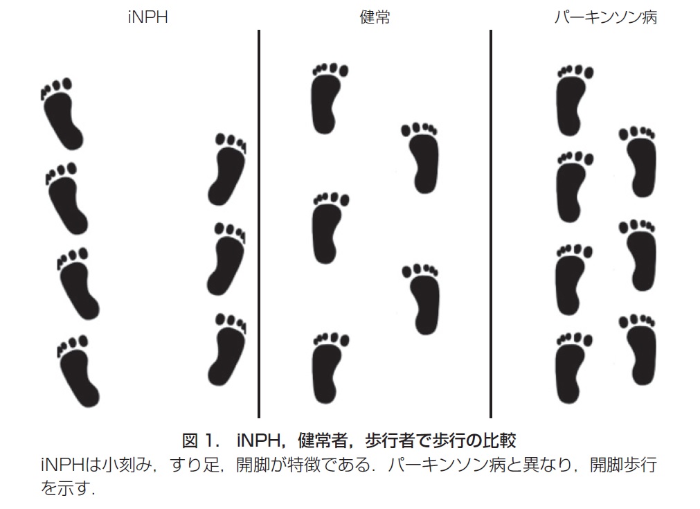 松下 ER ランチ・カンファレンス: Magnetic gait 磁石歩行