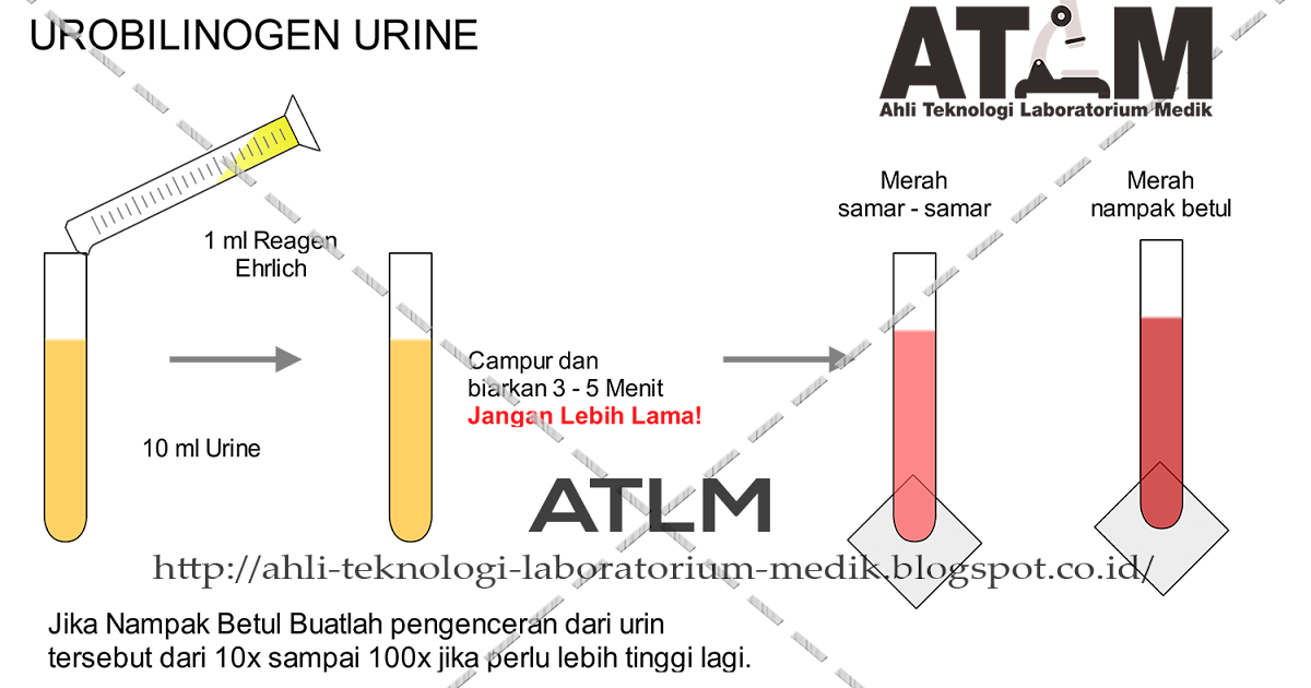 Pemeriksaan Urobilinogen Cara Wallace dan Diamond — Online Text Book ATLM