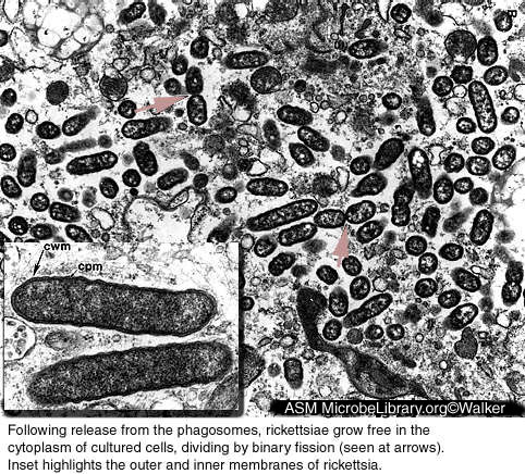 Penyakit Tifus | BIOLOGIPEDIA