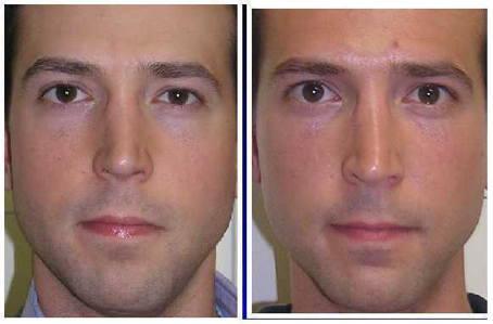 Facial Development Newsletter: A CONCEPT; INTEGRATING HOMEOBLOCK ...