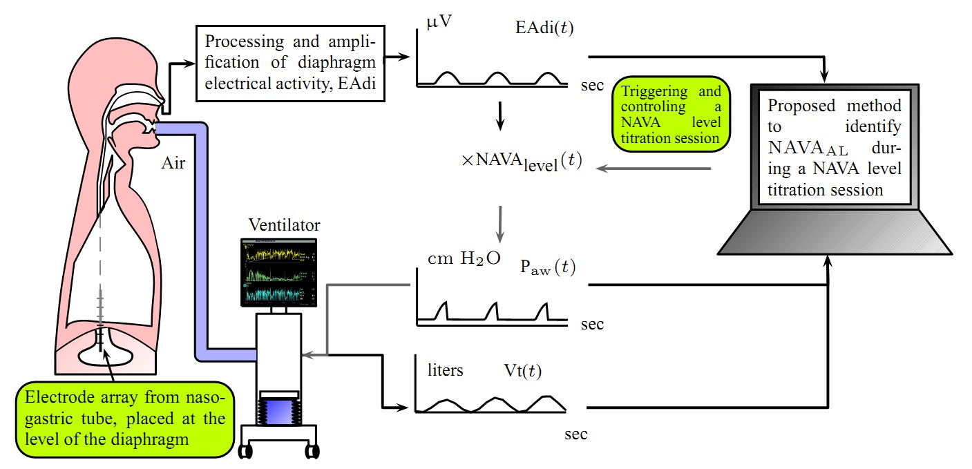 Neurally adjusted ventilation assist for critically ill patients