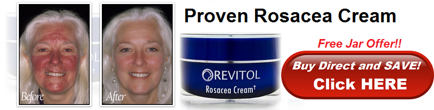 Revitol Canada Proven Beauty Products: Revitol Acnezine Rosacea Cream ...