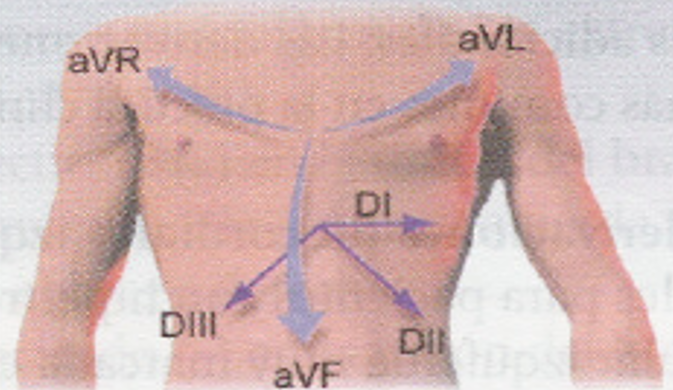 Urgencias y emergencias: Las derivaciones del electrocardiograma (I)