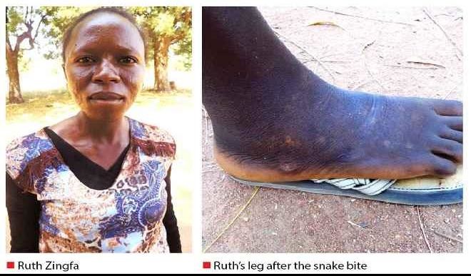 How 250 People Died Of Snake Bites In Gombe And Plateau