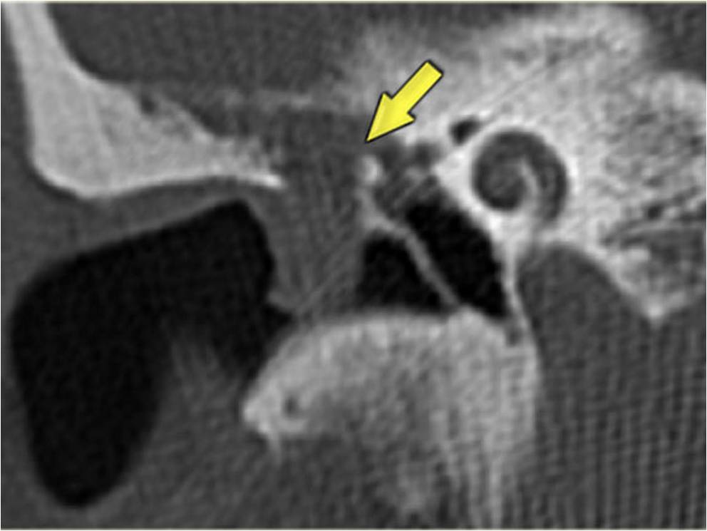 Radiologist For Ever: November 2011