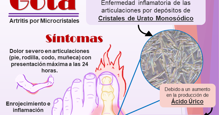 DIVULGACIÓN CIENTÍFICA UG: Gota