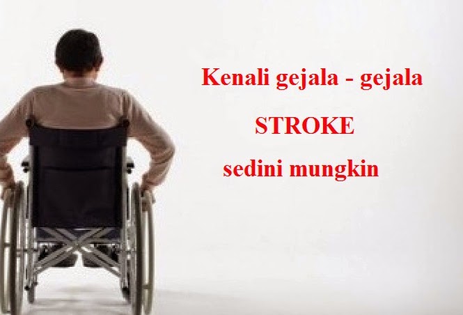 3 Gejala Umum Penyakit Stroke Yang mudah Diketahui