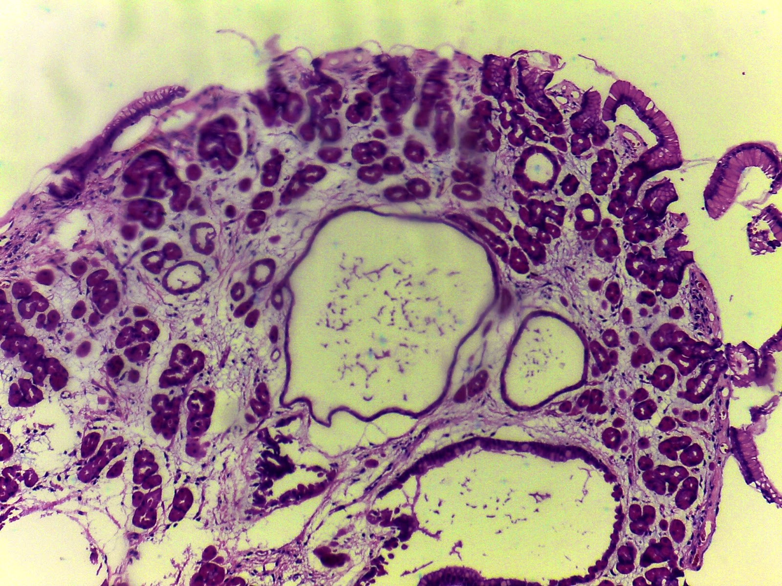 GASTROINTESTINAL AND LIVER HISTOLOGY PATHOLOGY ATLAS: STOMACH: FUNDIC ...