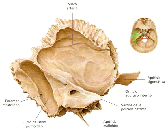 Anatomía y Neuroanatomía: Hueso Temporal. | Universidad Metropolitana ...