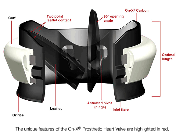 in my view ...: the heart of the matter