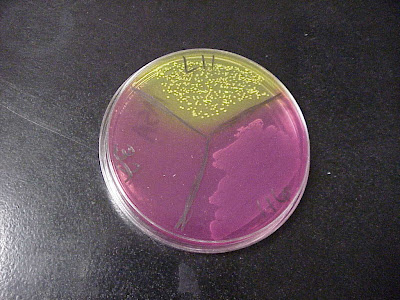 Wonalixia© Bittersweet: ESTAFILOCOCO DORADO (STAPHYLOCOCCUS AUREUS ...