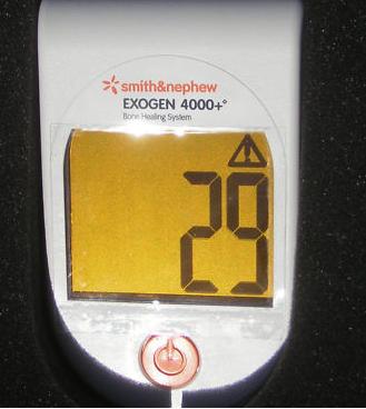 Taj the Saluki, His Broken Leg, and the Road to Recovery: Week 10 ...