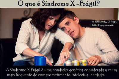 Gabriela Guarnieri Psicopedagoga: Síndrome X Frágil