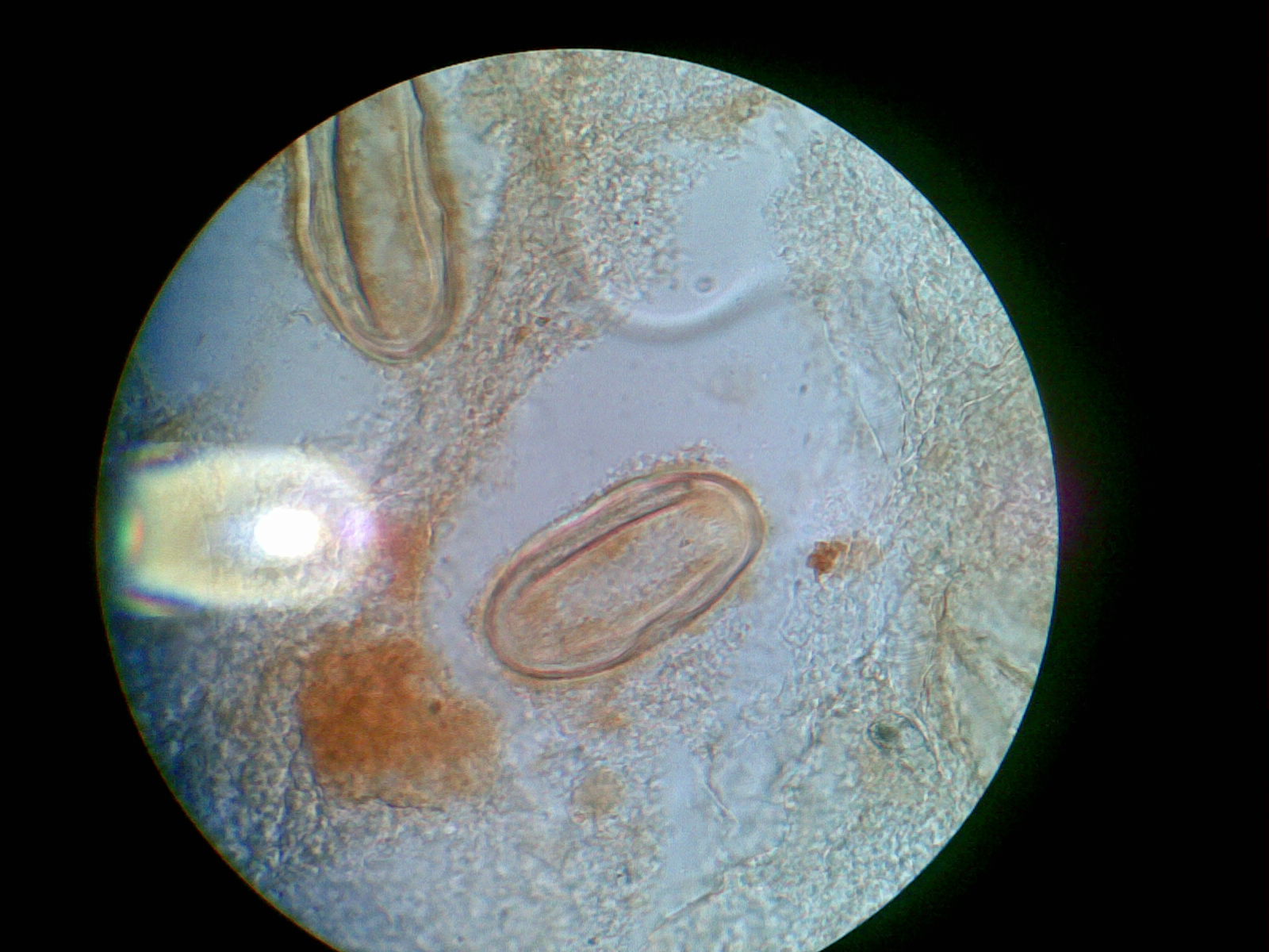 Ca - CaDo (Catatan Calon Dokter): Blok 9 : Praktikum Parasitologi ...
