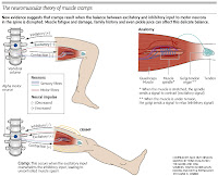 Paradise Tri Training: Exercise Induced Muscle Cramps
