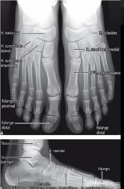 MMII-RX PIE DORSO Y PERFIL, AMBOS PIE