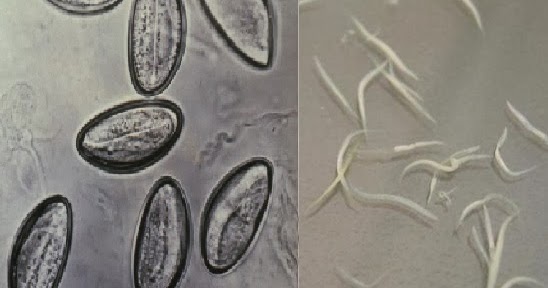 Worldwide University education USA: About pinworms [Enterobius ...