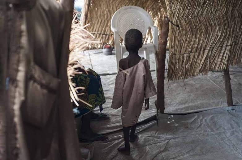 All skin and bones: AFP Correspondent photographs Nigerian starving ...