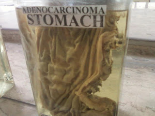 Medical Education for Students: Gross Specimens General Pathology (50 ...