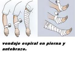 Enfermera en traumatología: Tipos de vendajes