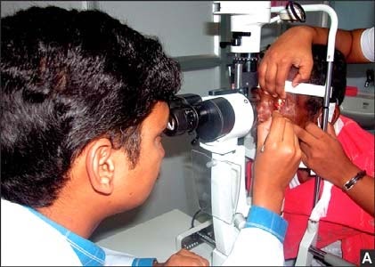 Ocular specimen collection | Tuyenlab