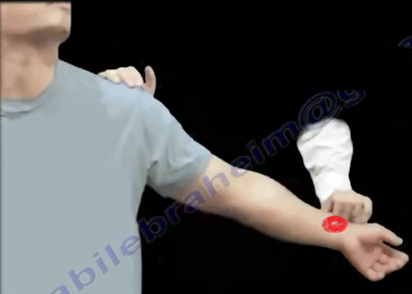 Dr. Nabil Ebraheim's Blogspot: Simple Tests for Diagnosis of ...