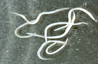 Penyebab Cacing Kremi dan Cara Mengatasinya - 7penyebab