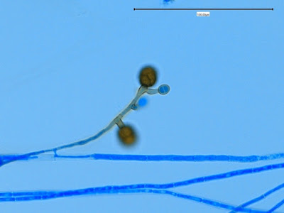 Fun With Microbiology (What's Buggin' You?): Stemphylium species