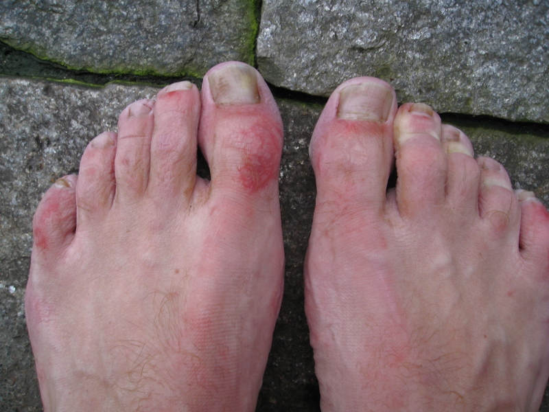 six months west: July 2011