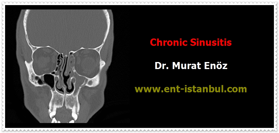 Sinusitis - Definition, Symptoms, Causes, Complications and Treatment