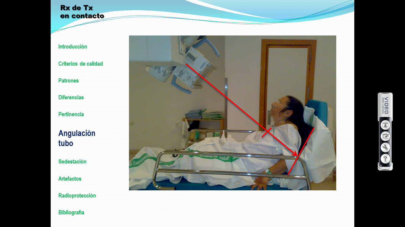 Tecnicos Radiologos: La posición del paciente encamado en Rx Tx en Contacto