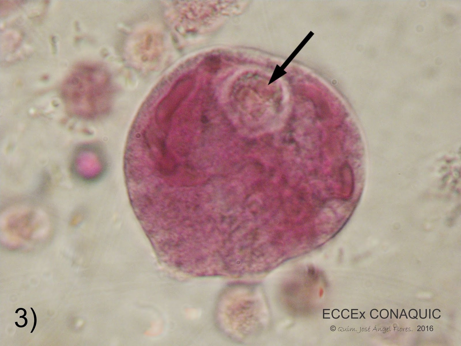 Examen General de Orina: octubre 2016